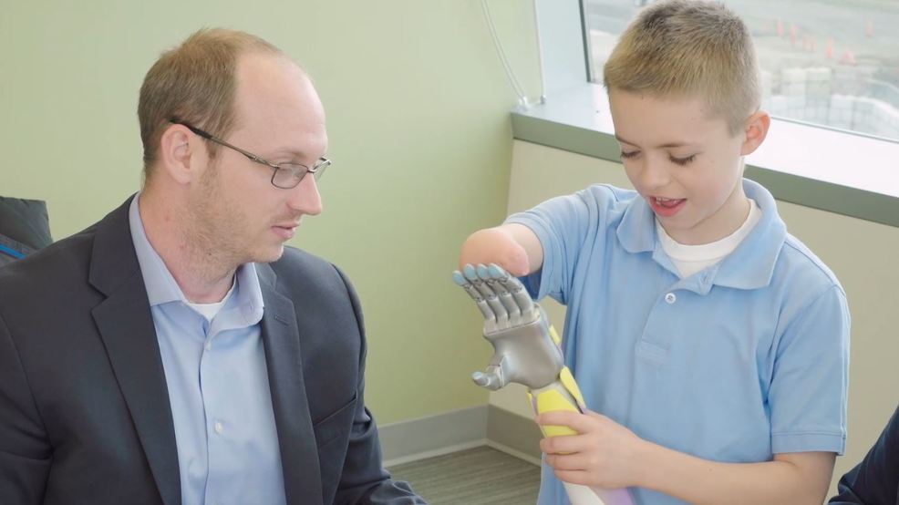 Clinical trial connects kids born with congenital limb loss with 3-D ...